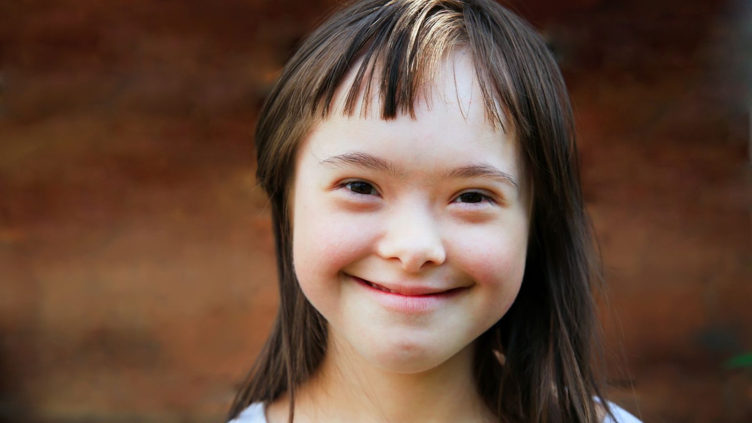 Understanding The Common Physical Characteristics Of Down Syndrome