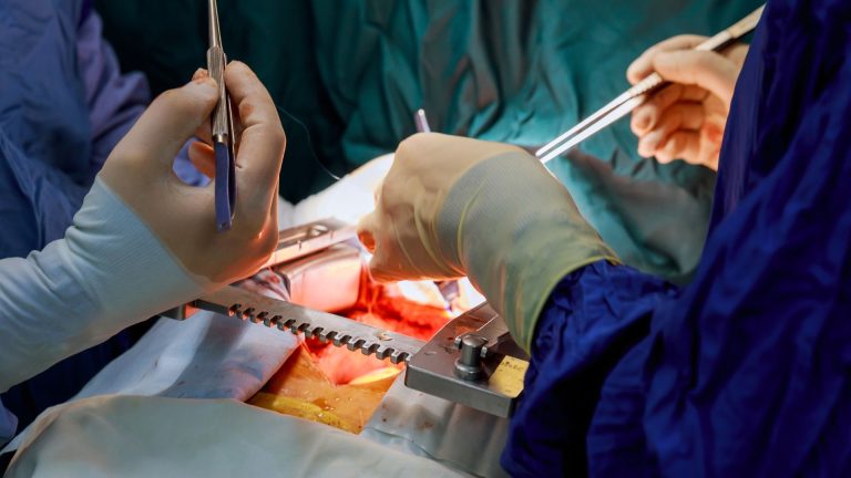 The Risks Of Open Heart Surgery A Doctor S Perspective